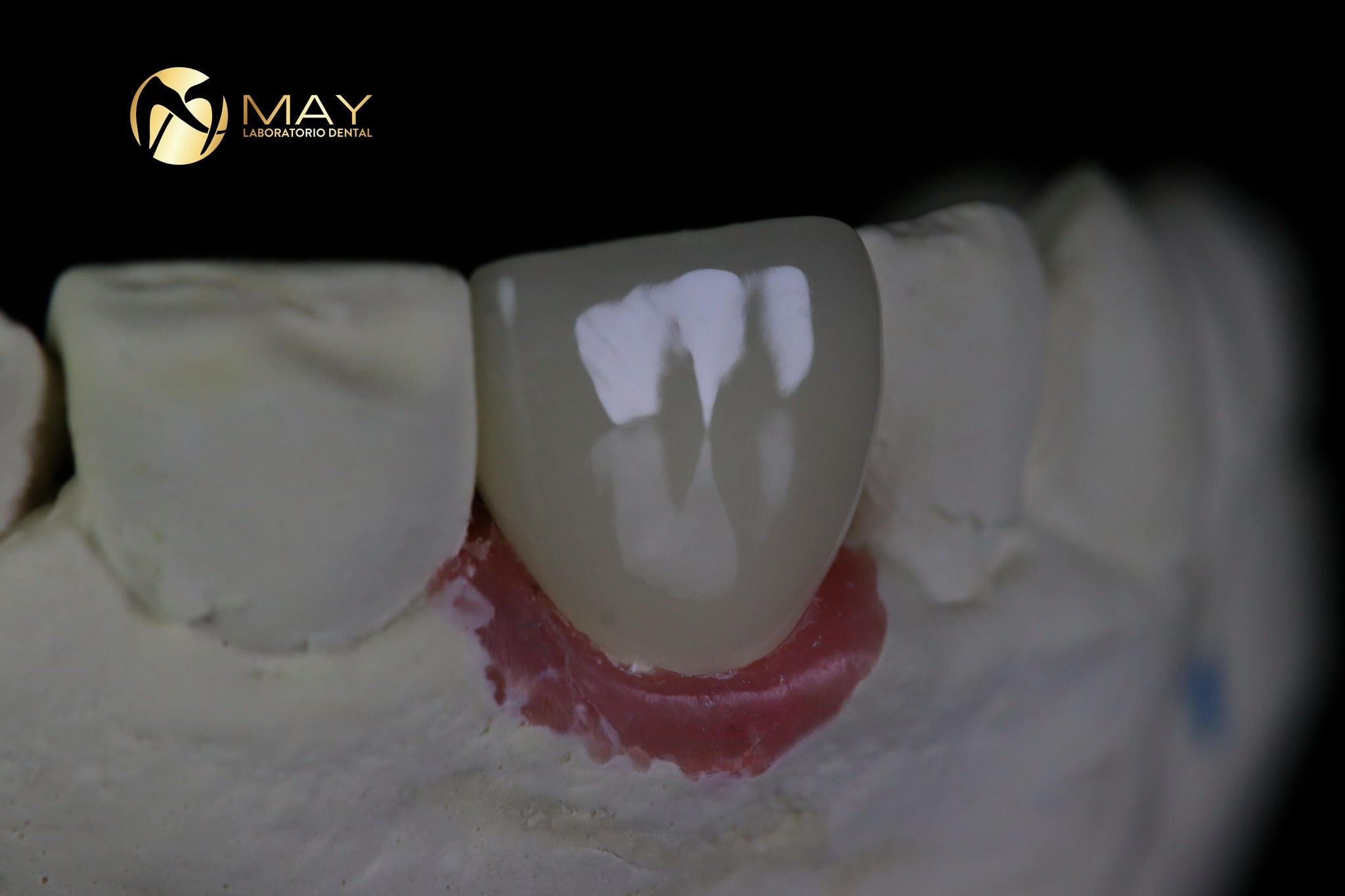 Lithium disilicate – Wissden