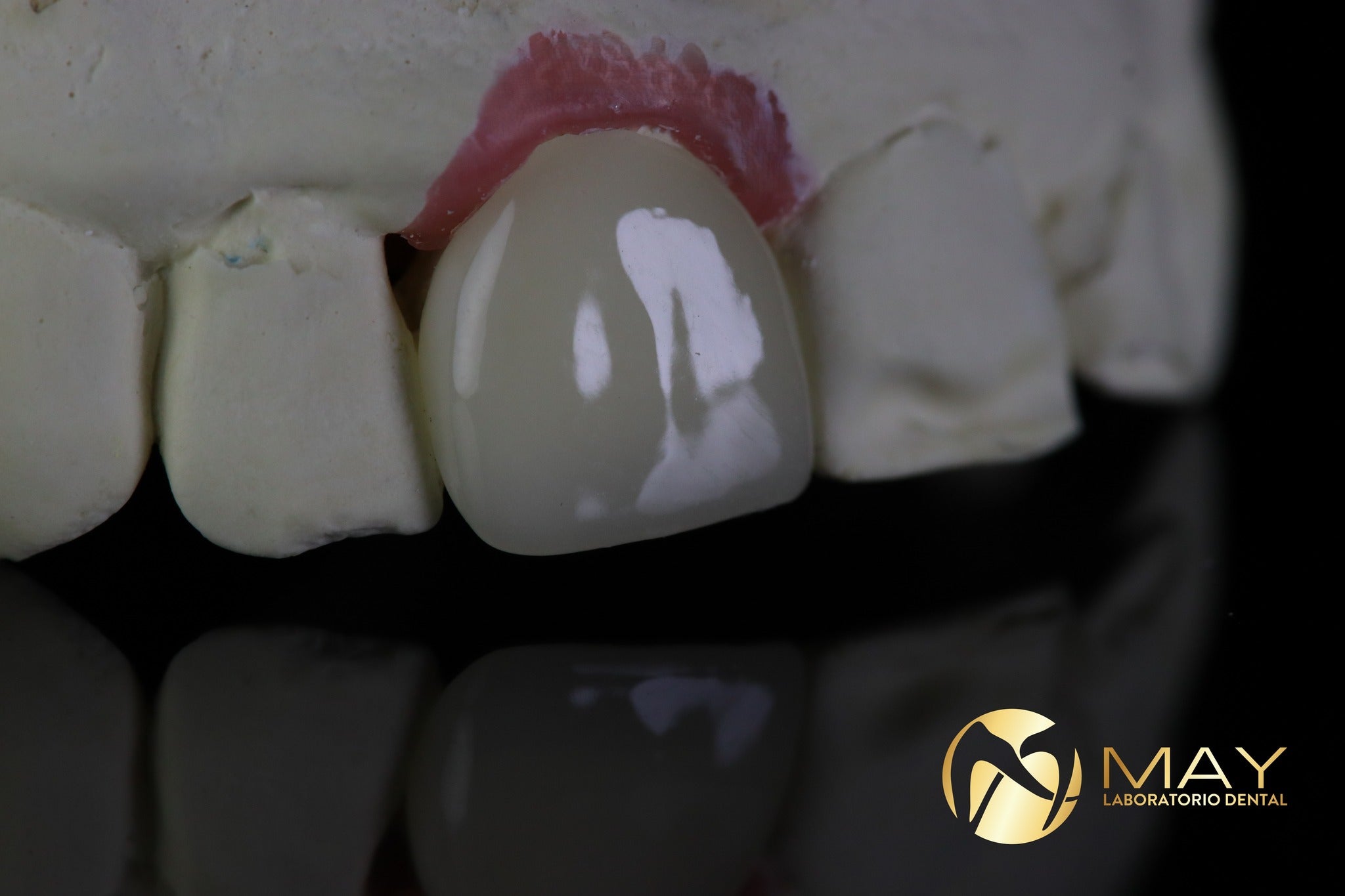 Lithium disilicate – Wissden