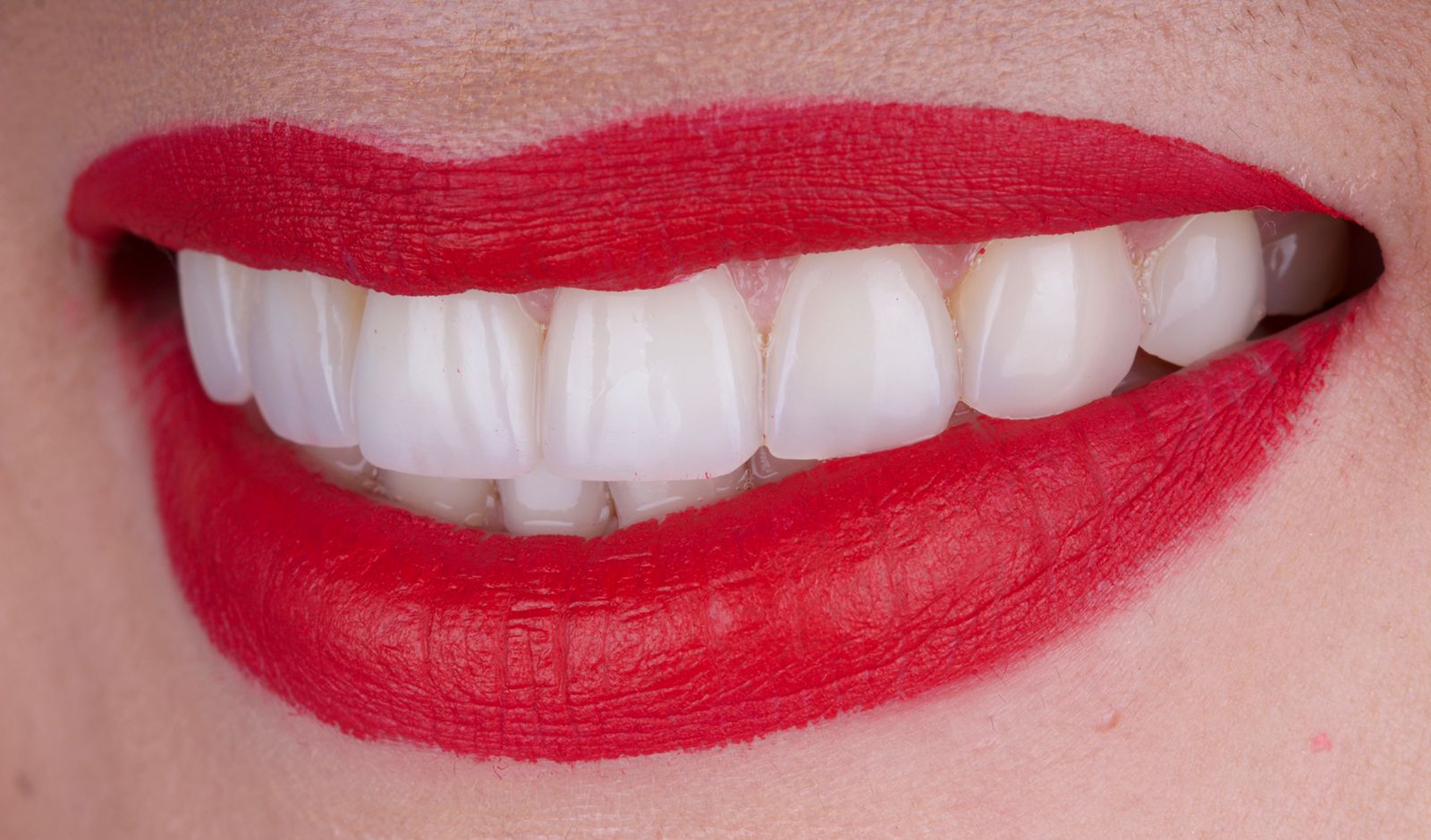 Lithium disilicate – Wissden