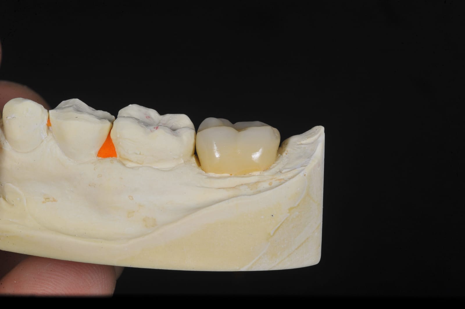 Lithium disilicate – Wissden